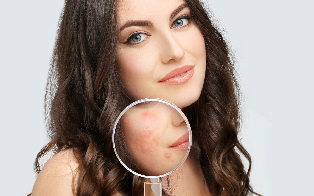 Il trattamento delle cicatrici: Cosa funziona davvero e cosa no - Il ...