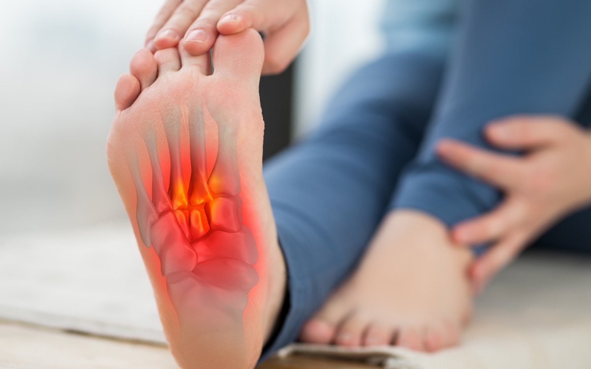 Fascite Plantare: Allevia il Dolore e Torna a Camminare Bene - Blog